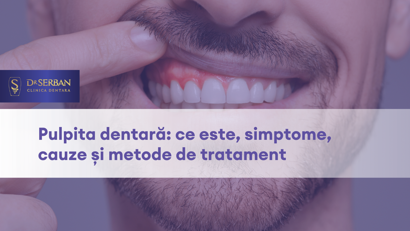 Pulpita Dentară: Ce Este, Simptome, Cauze și Metode De Tratament ...
